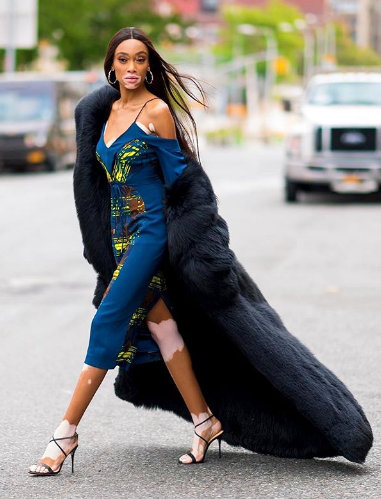 Winnie Harlow: modelo com vitiligo que brilha no Victoria s Secret ...